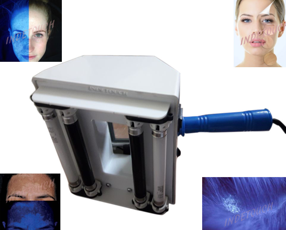 Indetouch™ Woods Lamp For Skin Examination ( 4 Light Magnifier Model ...